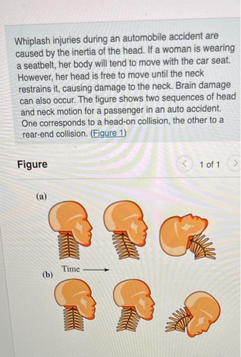 Solved Whiplash injuries during an automobile accident are | Chegg.com