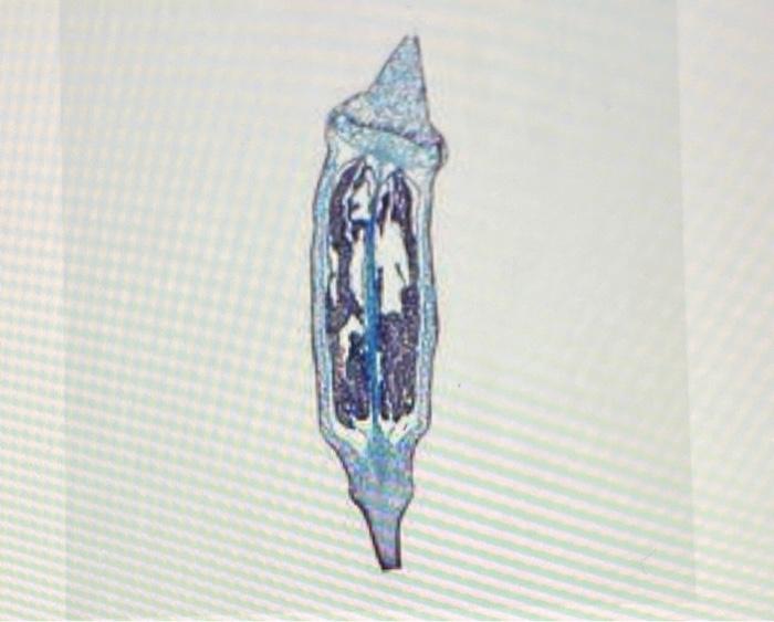 Solved identify the stalk, capsule, operculum, peristome | Chegg.com