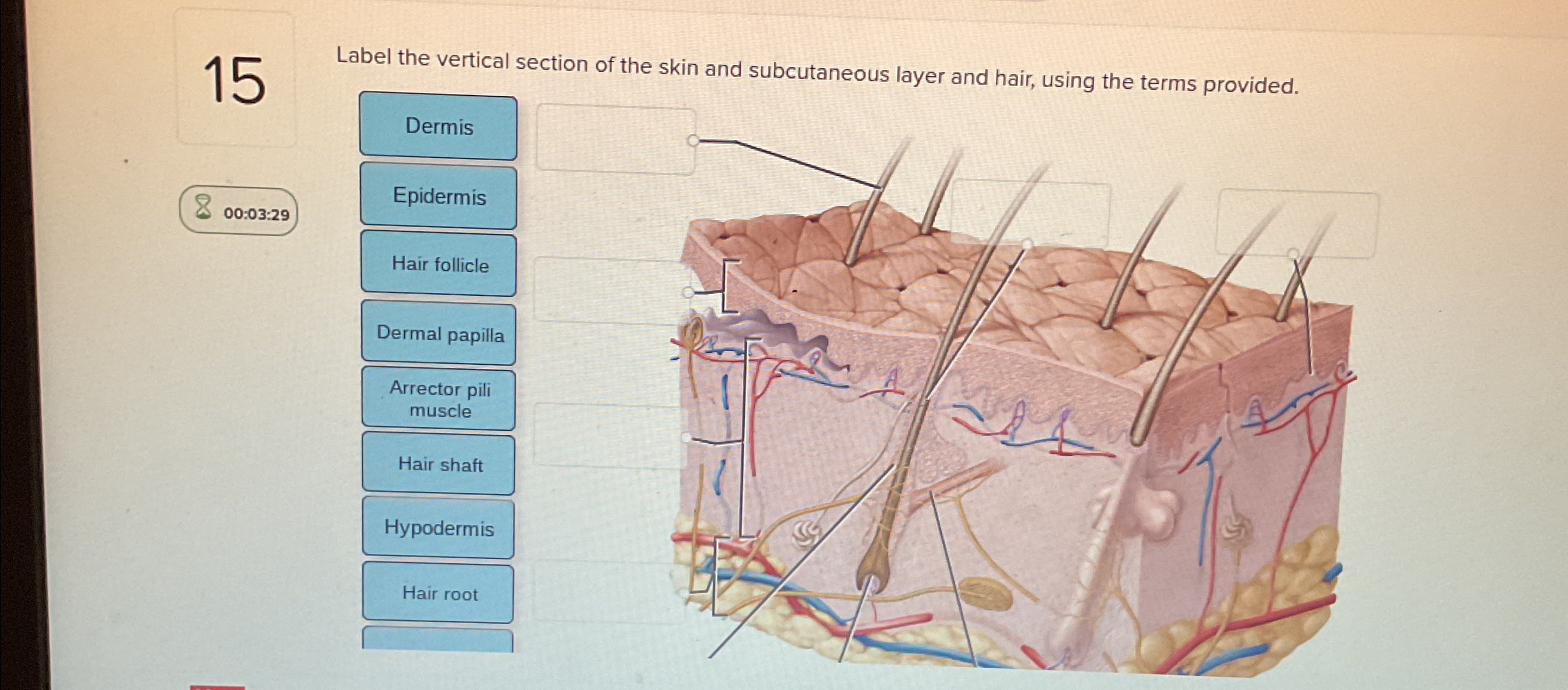 Solved 1500 03 29label The Vertical Section Of The Skin And