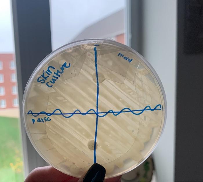 Examine your TSA plates with the antibiotic and mold | Chegg.com