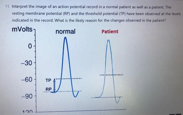 Solved a 11. Interpret the image of an action potential | Chegg.com