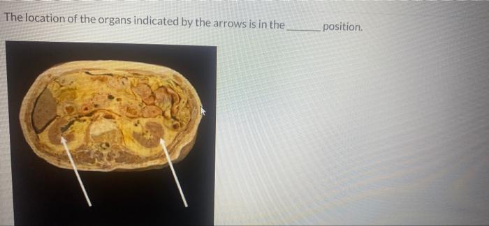 Solved The location of the organs indicated by the arrows is | Chegg.com
