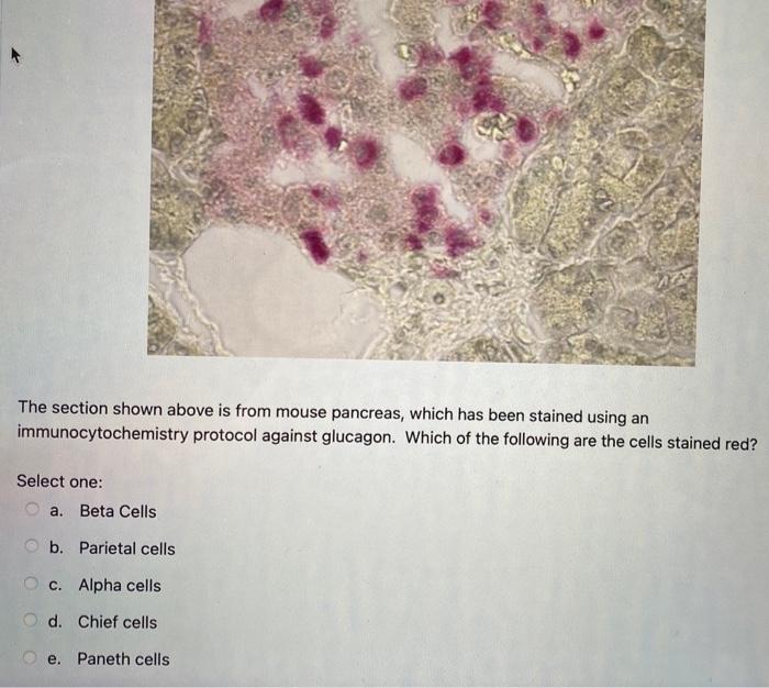 Solved The section shown above is from mouse pancreas, which | Chegg.com