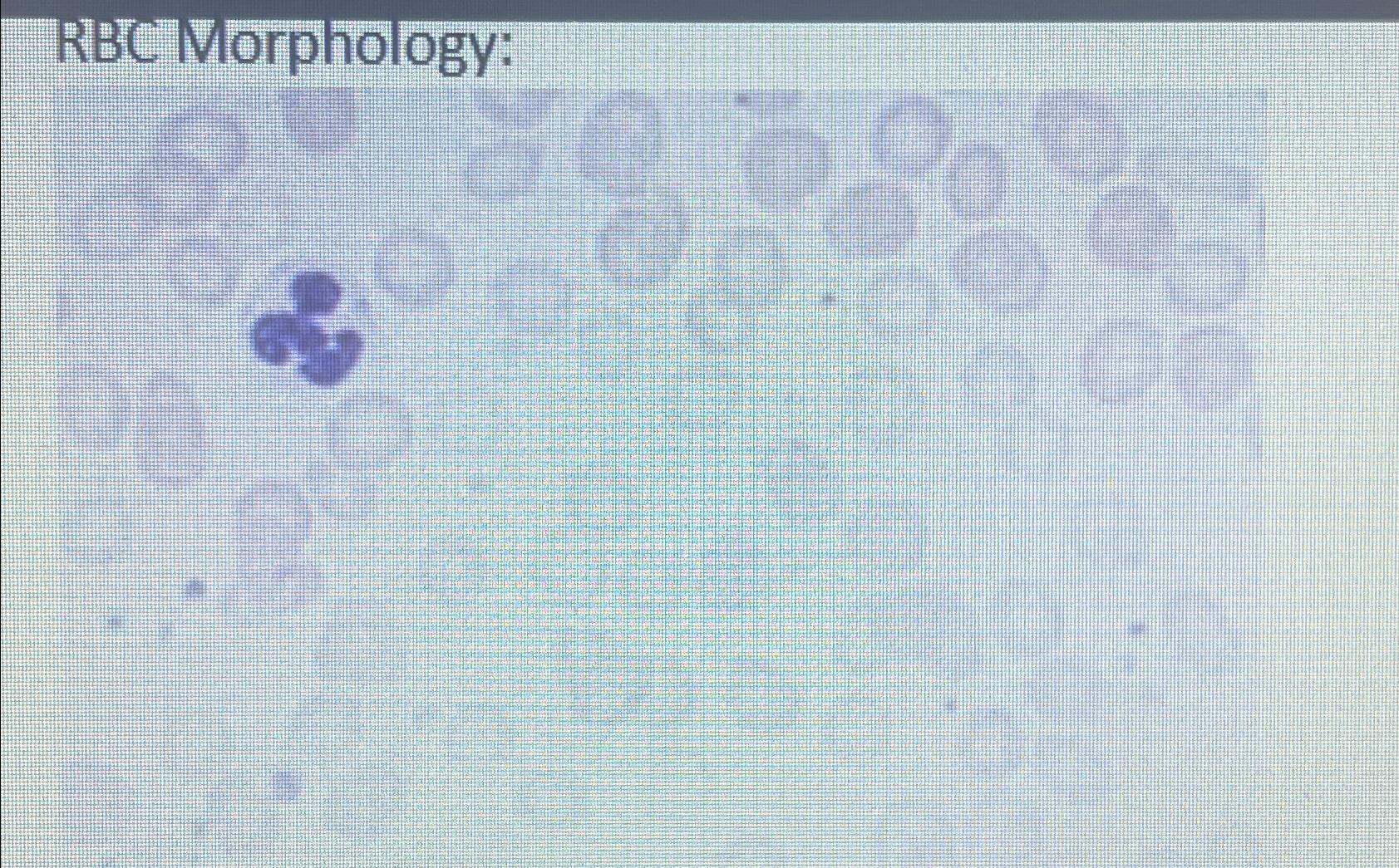 Solved What is this images RBC Morphology? Please describe | Chegg.com