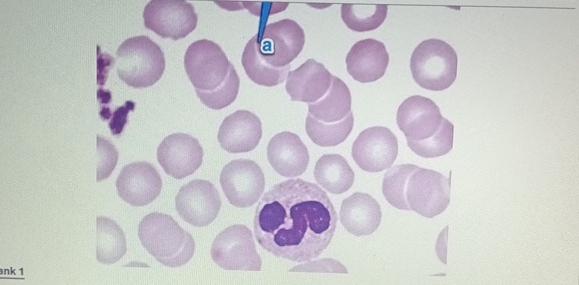 Solved Name the Blood Cell (formed element) ﻿at the tip of | Chegg.com