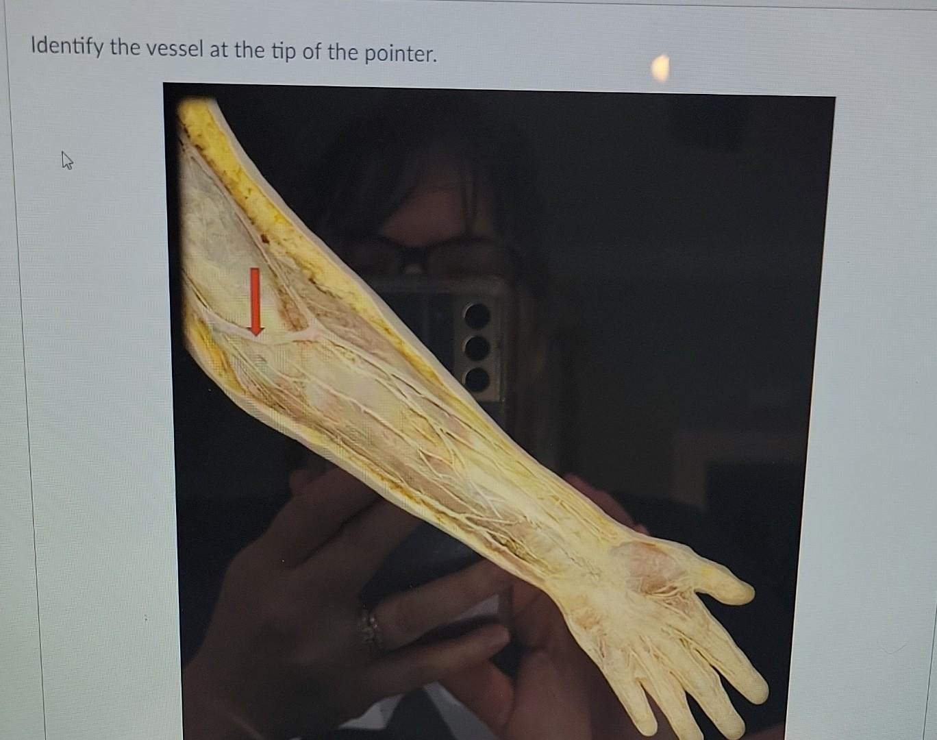 Solved Identify the vessel at the tip of the | Chegg.com