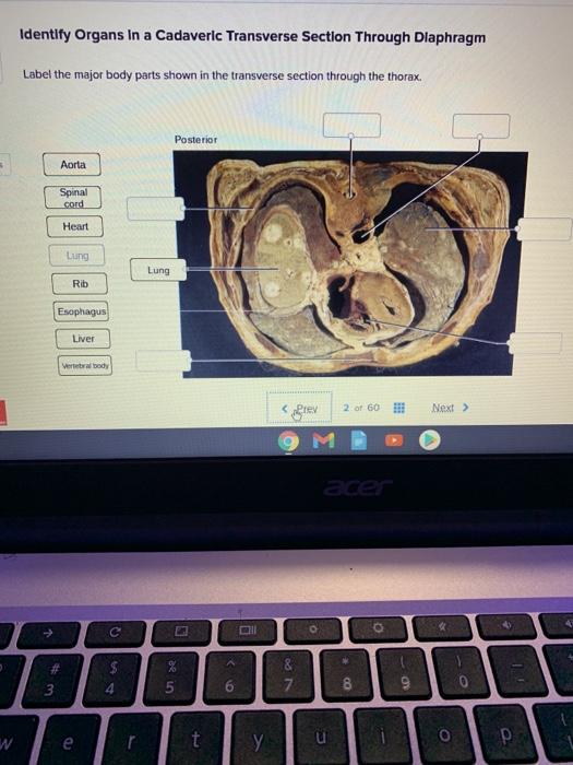 Solved Identify Organs In a Cadaveric Transverse Section | Chegg.com