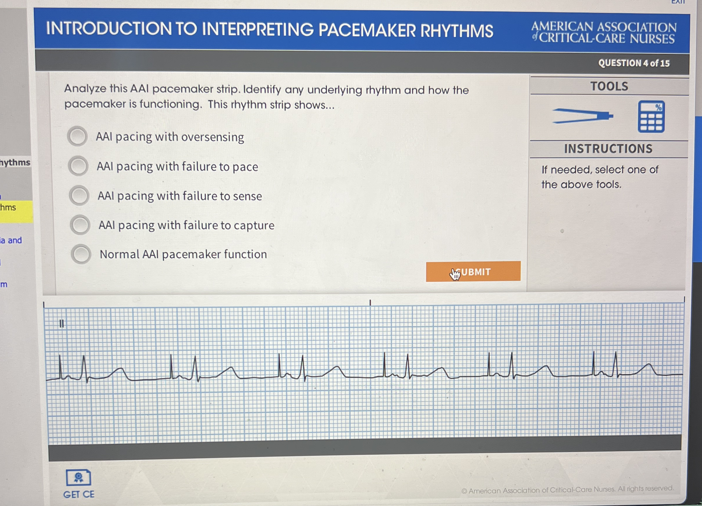 Solved Analyze this VVI pacemaker strip. Identify any | Chegg.com