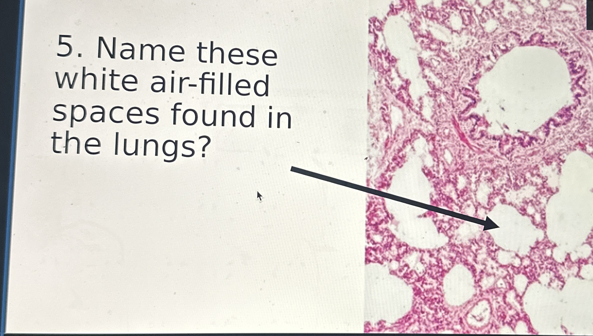 Solved Name these white air-filled spaces found in the | Chegg.com