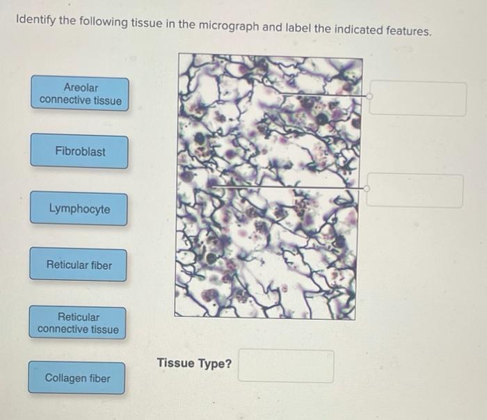 Solved Identify the following tissue in the micrograph and | Chegg.com Solved Identify the following tissue in the micrograph and | Chegg.com