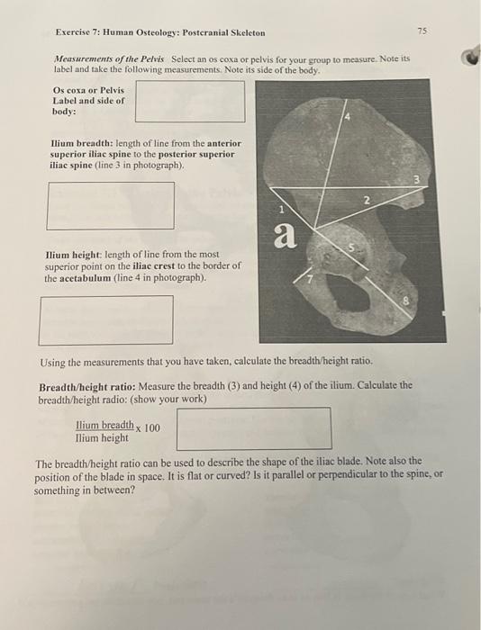 Exercise 7: Human Osteology: Postcranial Skeleton | Chegg.com