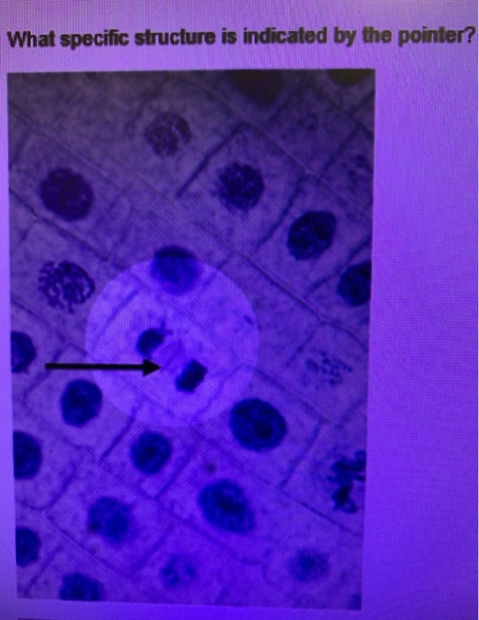 Solved What specific structure is indicated by the pointer? | Chegg.com