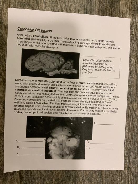 Solved Midline Anatomy Making midline cut: Once you can | Chegg.com