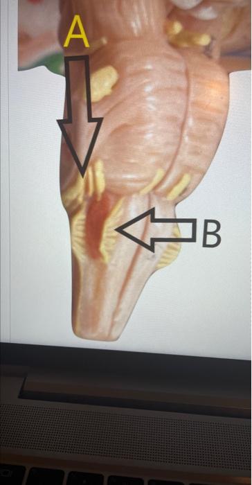 Solved name the yellow structure at the tip of arrow B | Chegg.com
