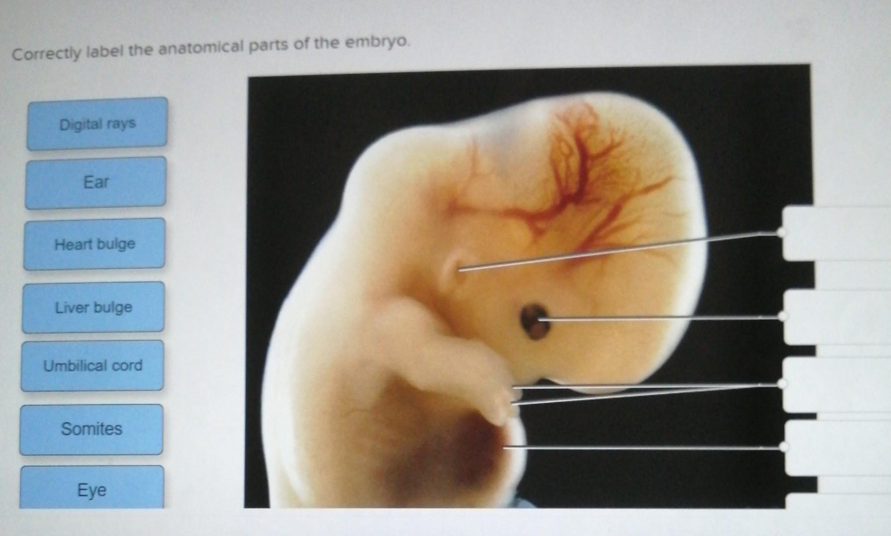 Correctly label the anatomical parts of the embryo. | Chegg.com