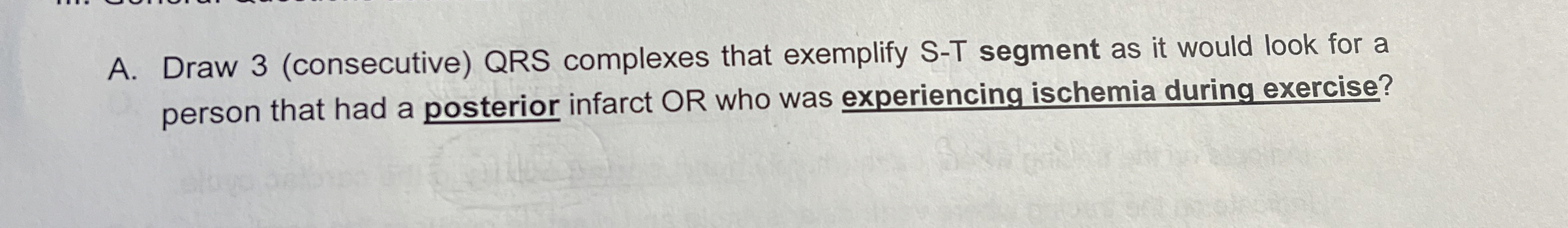 Solved A. ﻿Draw 3 (consecutive) ﻿QRS complexes that | Chegg.com