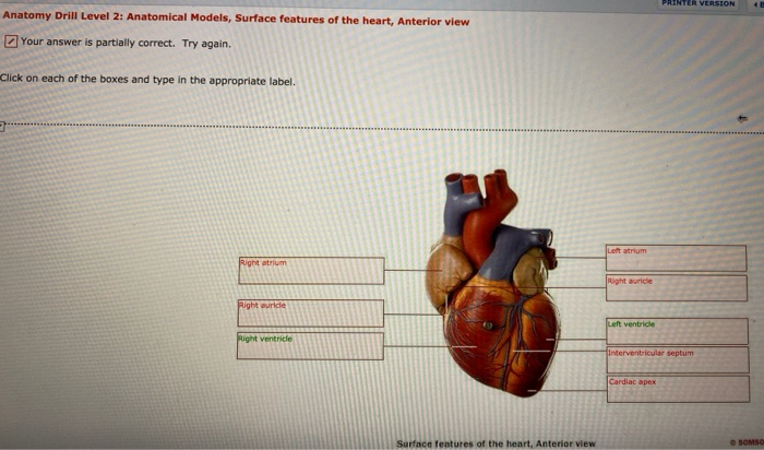 Solved Anatomy Drill Level 2: Anatomical Models, Surface | Chegg.com