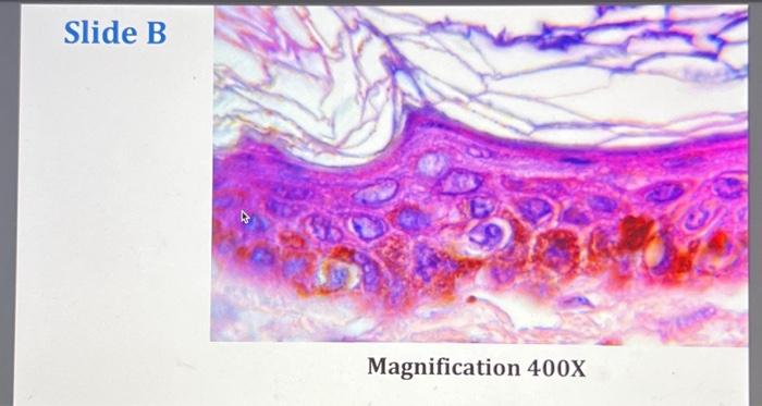 Solved Slide F Magnification 1000X Hint: this is not an | Chegg.com