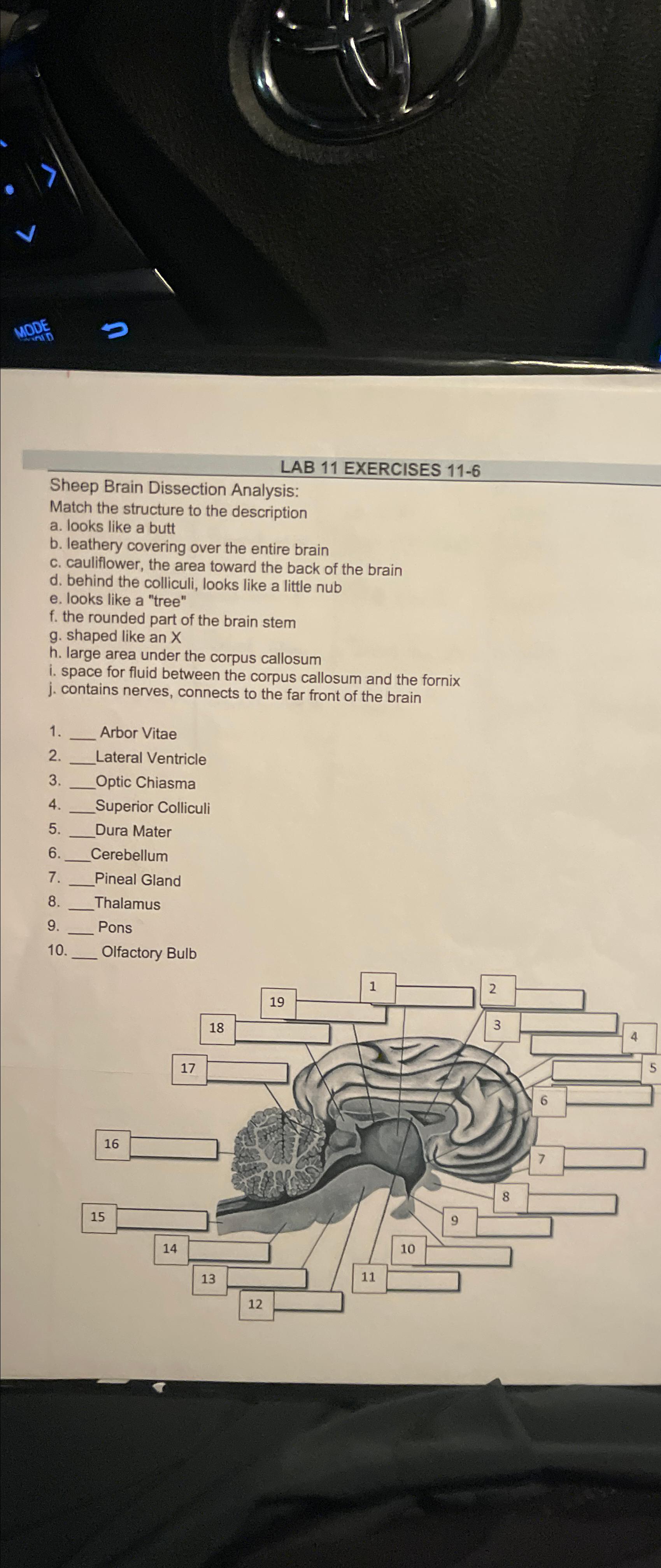 Solved LAB 11 ﻿EXERCISES 11-6Sheep Brain Dissection | Chegg.com