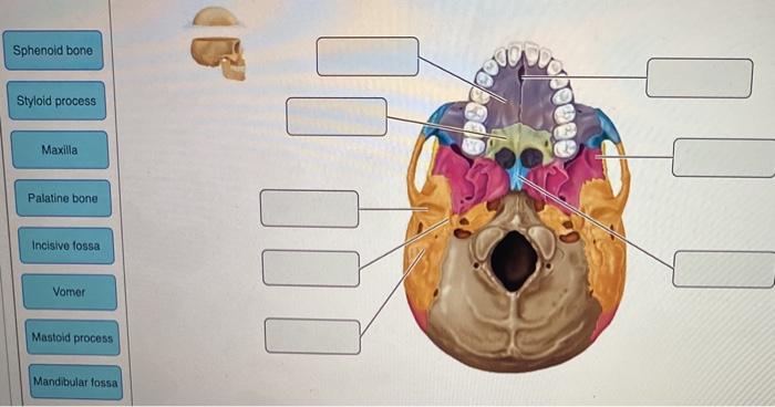 Solved Sphenoid bone Styloid process Maxilla Palatine bone | Chegg.com