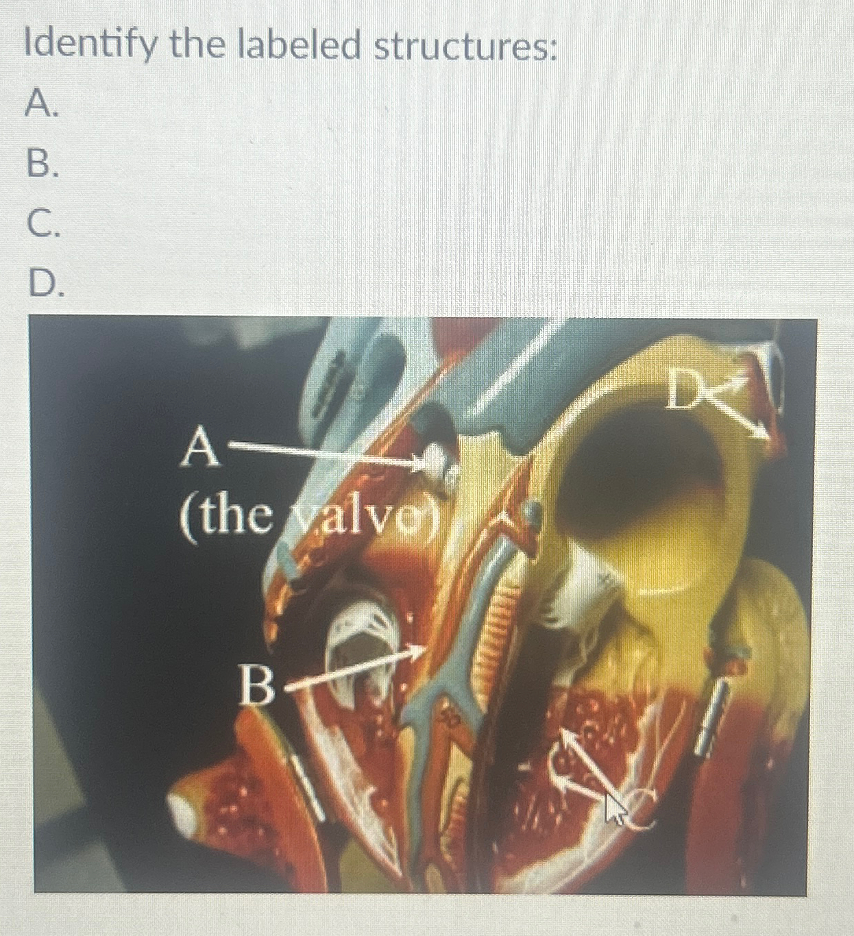 Solved Identify the labeled structures:A.B. | Chegg.com