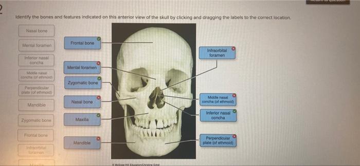 Solved 2 Identify the bones and features indicated on this | Chegg.com