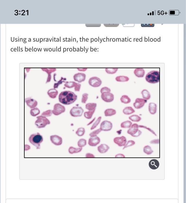 Solved 3:21 .1 5G+ Using a supravital stain, the | Chegg.com