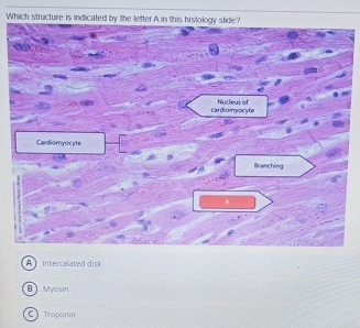 Solved Which structure is indicated by the letter A in this | Chegg.com