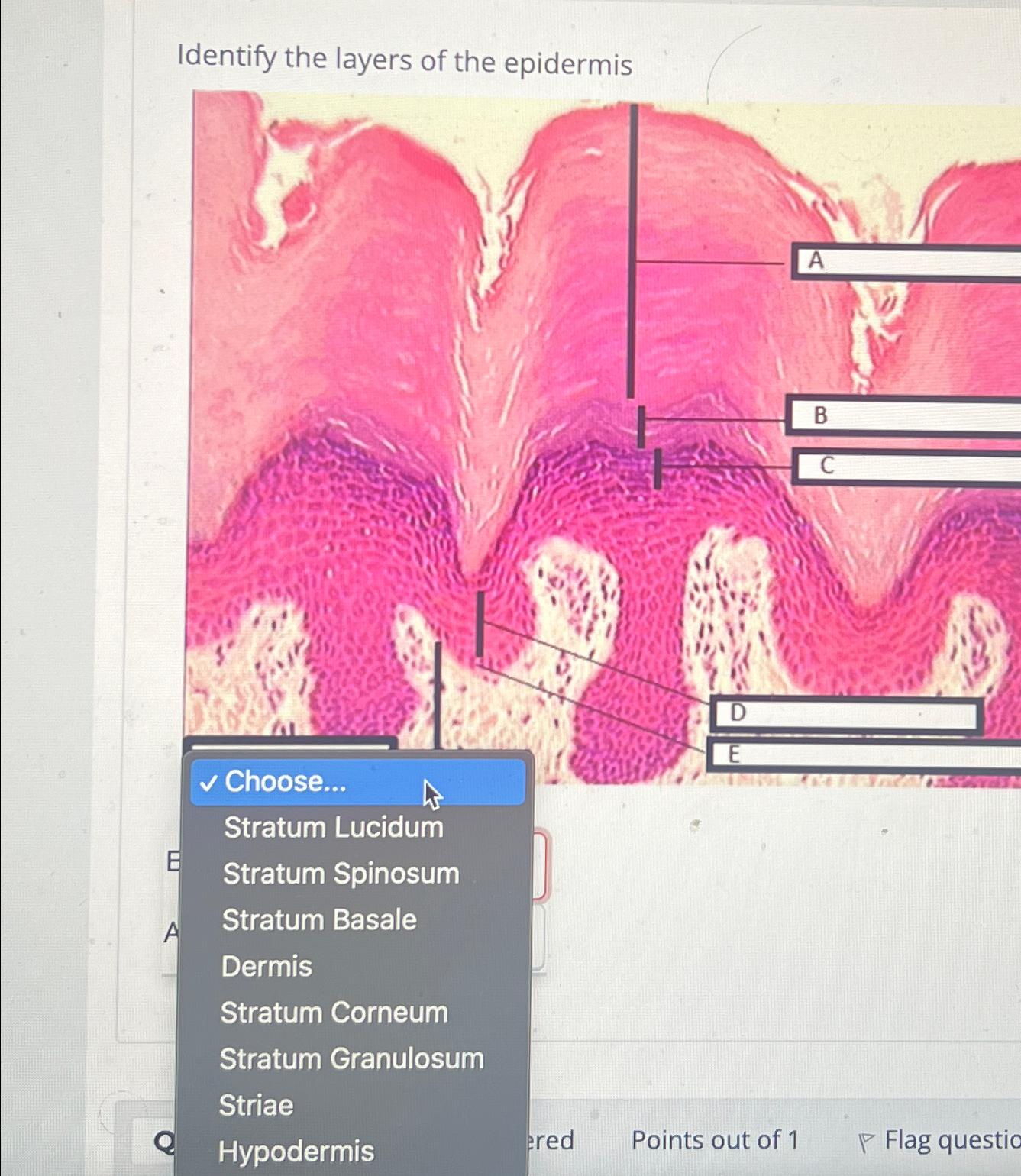 Solved Identify the layers of the | Chegg.com