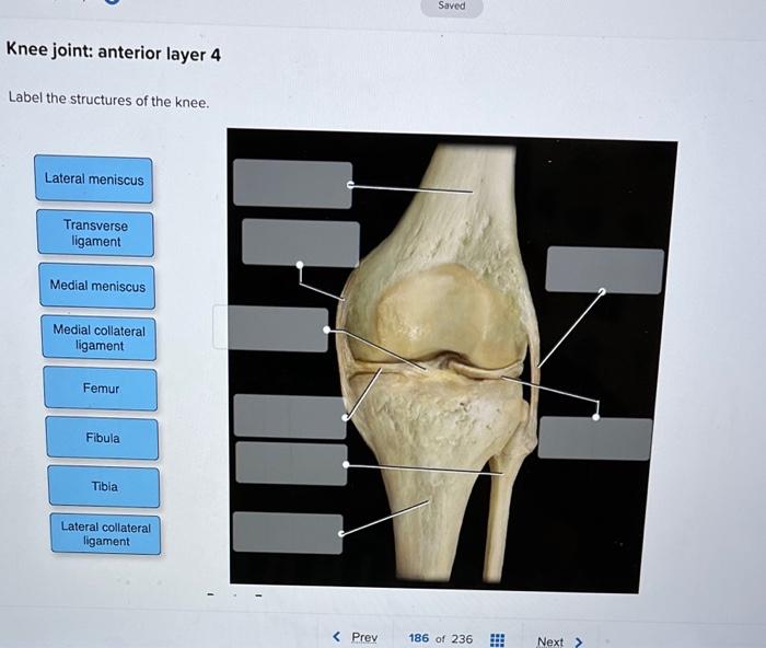 Solved Knee joint: anterior layer 4 Label the structures of | Chegg.com