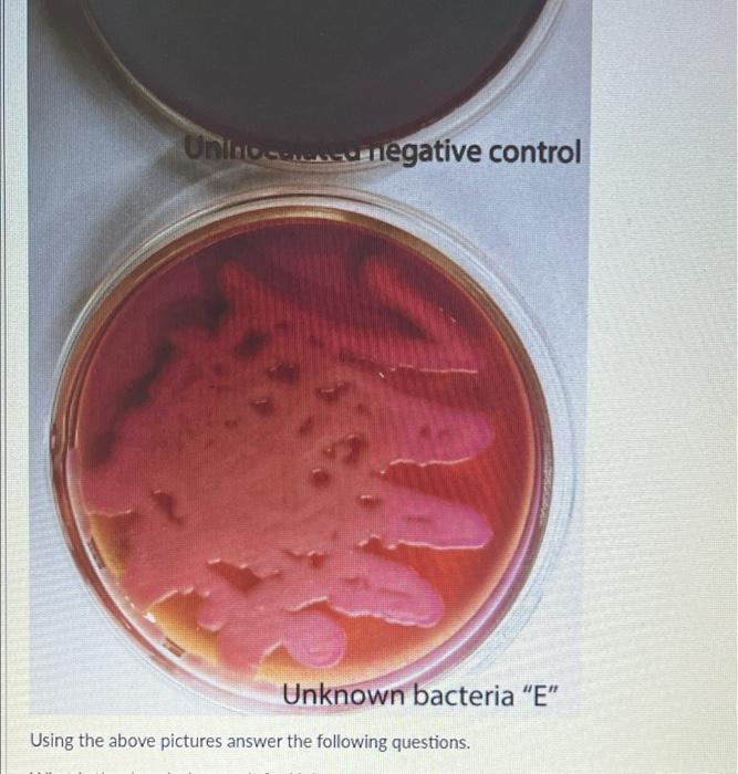 Solved MacConkey agar (4-4) MacConkey Agar Uninoculated | Chegg.com