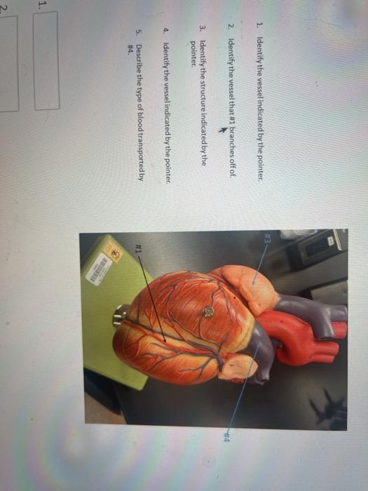 Solved 1. Identify the vessel indicated by the pointer 2. | Chegg.com