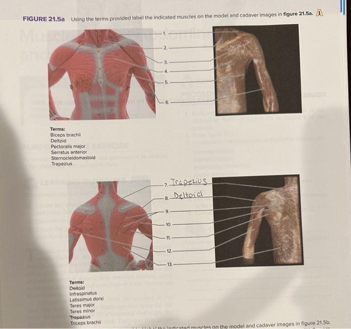 Solved FIGURE 21.5a Using the terms provided label the | Chegg.com