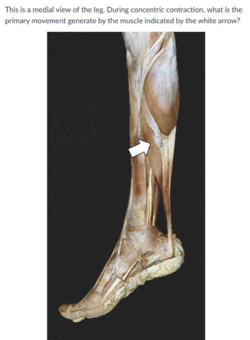 Solved This is a medial view of the leg. During concentric | Chegg.com