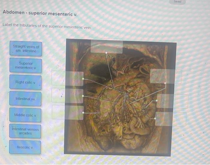 Solved Abdomen - superior mesenteric v. Label the | Chegg.com