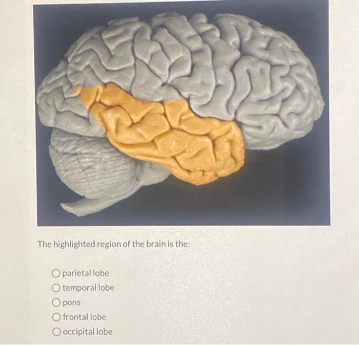 Solved The highlighted region of the brain is the: parietal | Chegg.com