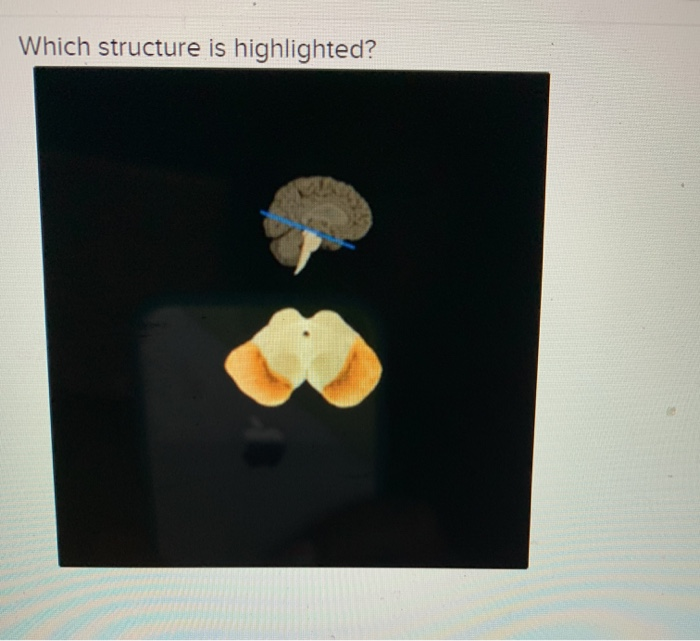 Solved Which structure is highlighted? basal nuclei O O | Chegg.com Solved Which structure is highlighted? basal nuclei O O | Chegg.com