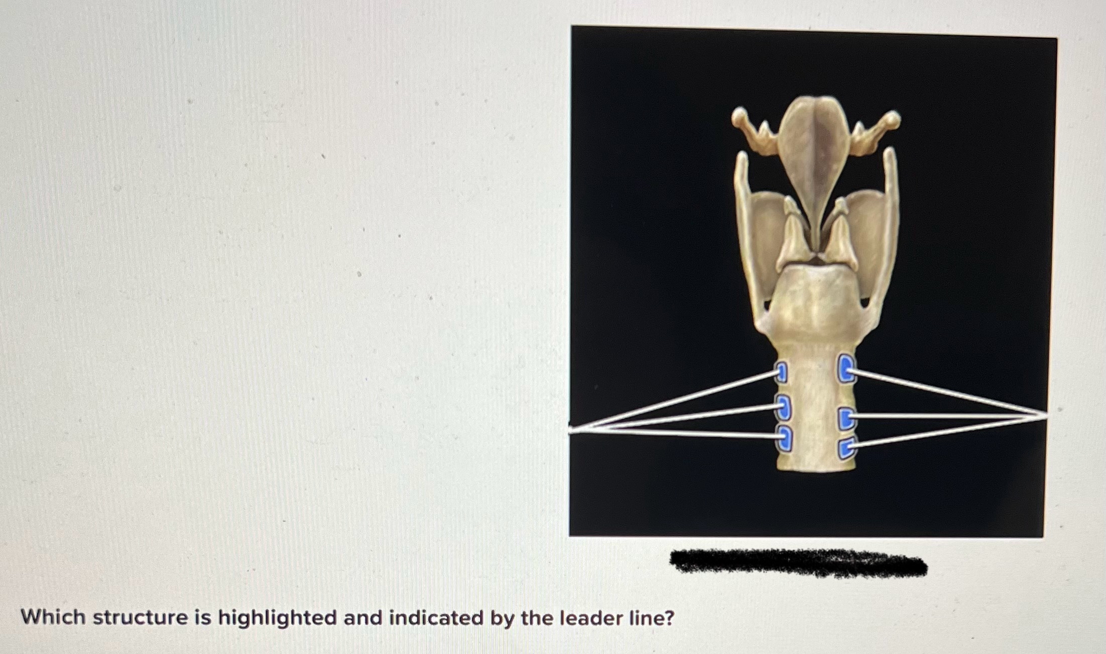 Solved Which structure is highlighted and indicated by the | Chegg.com