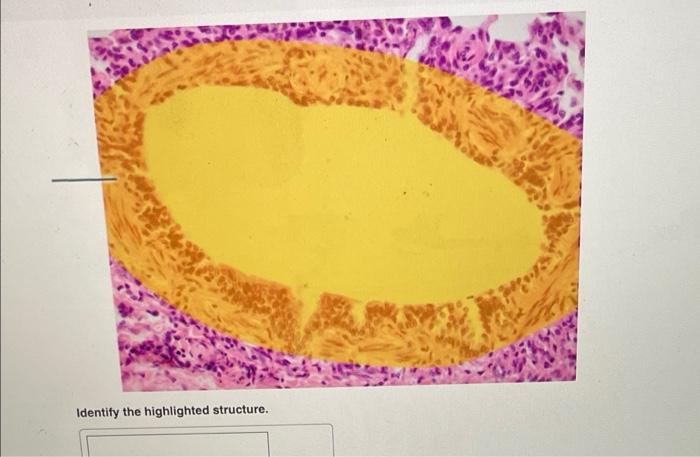 Solved Identify the highlighted structure. Identify the | Chegg.com