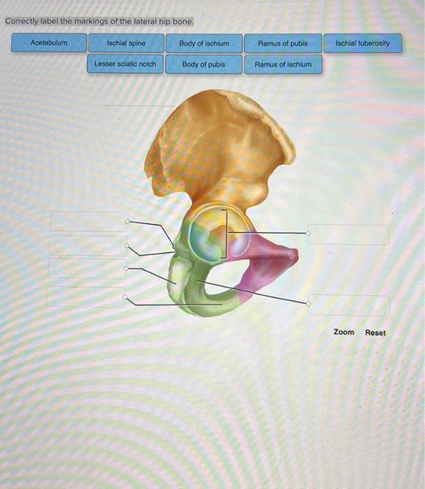 Solved Correctly label the markings of the lateral hip bone. | Chegg.com