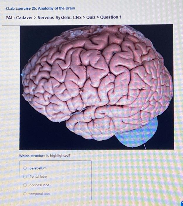 Solved Nervous System: CNS > Quiz > Question 19 Which | Chegg.com