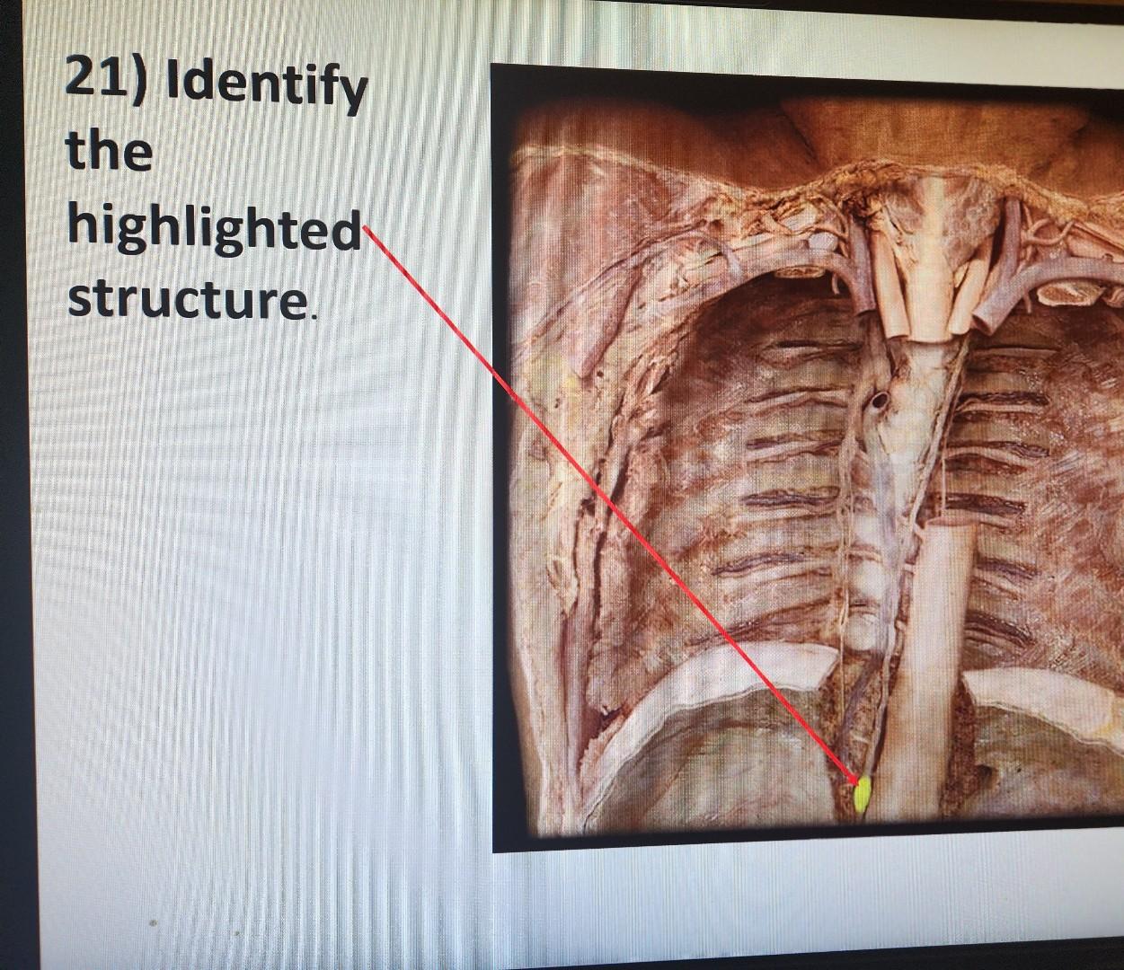 Solved Identify the highlighted structure. | Chegg.com