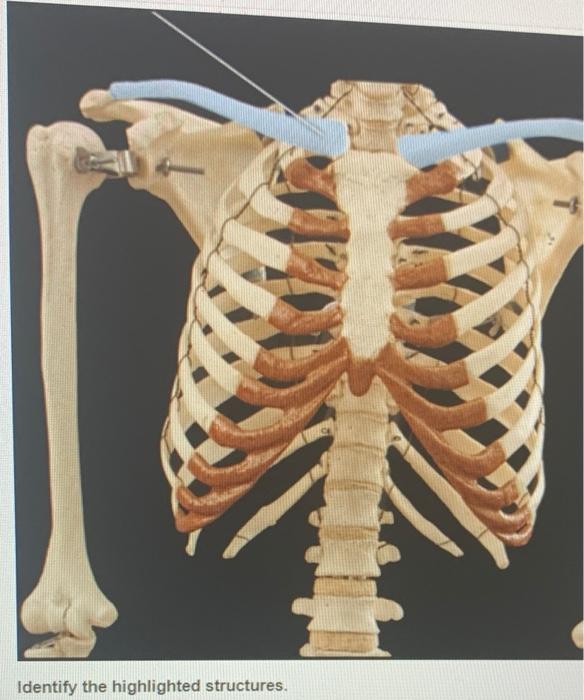 Solved Identify the highlighted structures. Name the type | Chegg.com