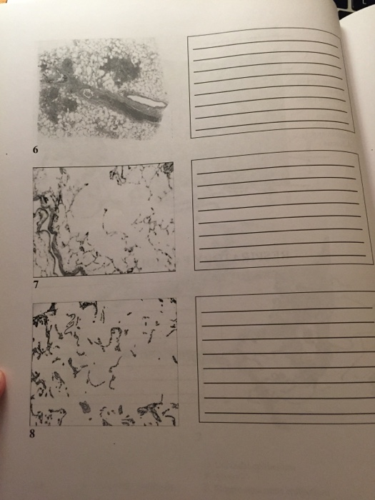 Solved PART II IN CLASS and HOMEWORK ASSIGNMENTS RESPIRATORY | Chegg.com