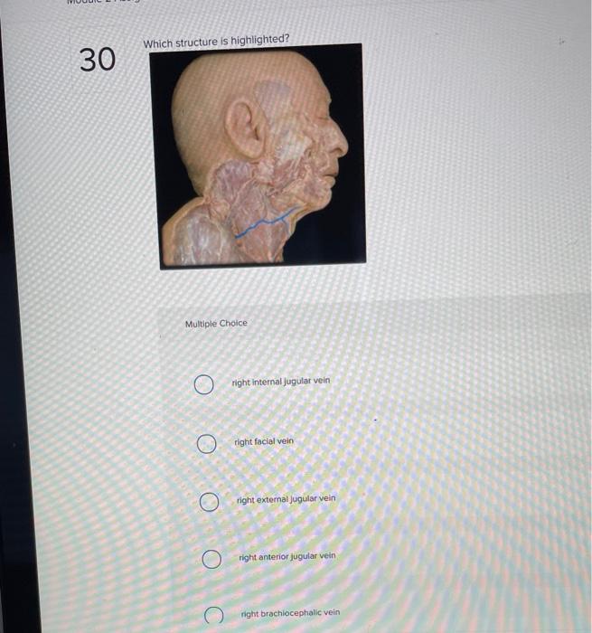 Solved Which structure is highlighted? 30 Multiple Choice O | Chegg.com