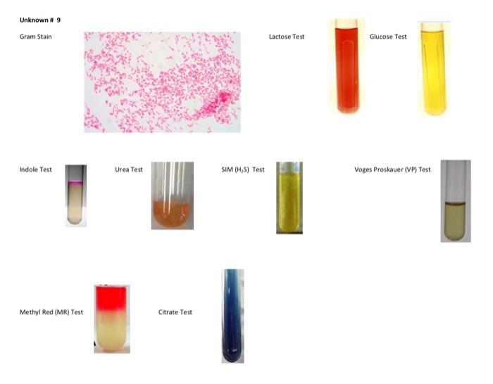 Solved Unknown #12 Gram Stain Spore Stain 10um Catalase Test | Chegg.com