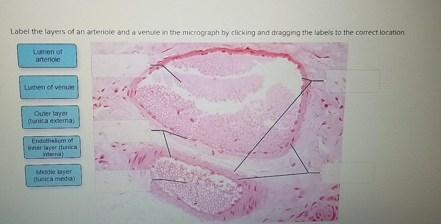 Solved Label the layers of an arteriole and a venule in the | Chegg.com