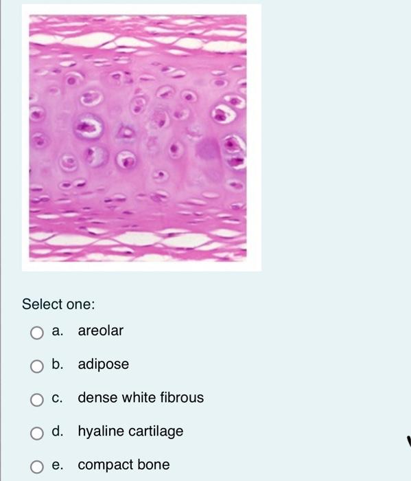 Solved Select one: a. areolar b. adipose c. dense white | Chegg.com