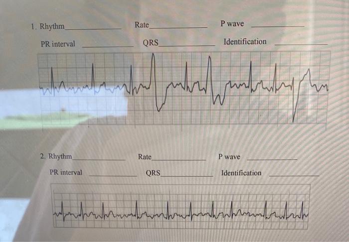 1. Rhythm Rate P wave PR interval QRS 2. Rhythm Rate | Chegg.com