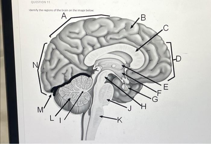 Solved QUESTION 11 Identify the regions of the brain on the | Chegg.com